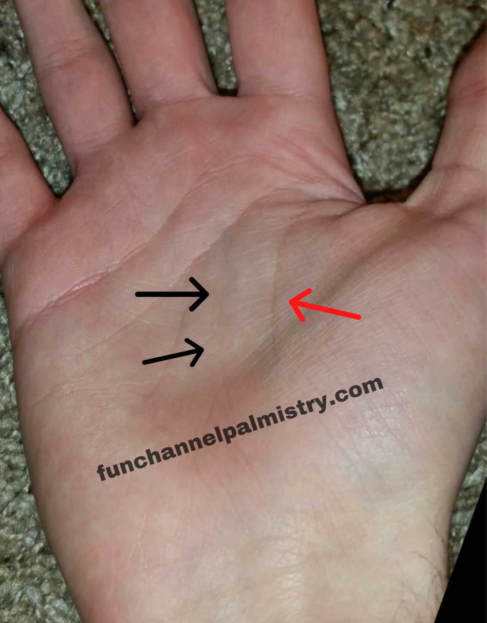 Palm Analysis Of A Stressed Person At A Young Age-Palmistry