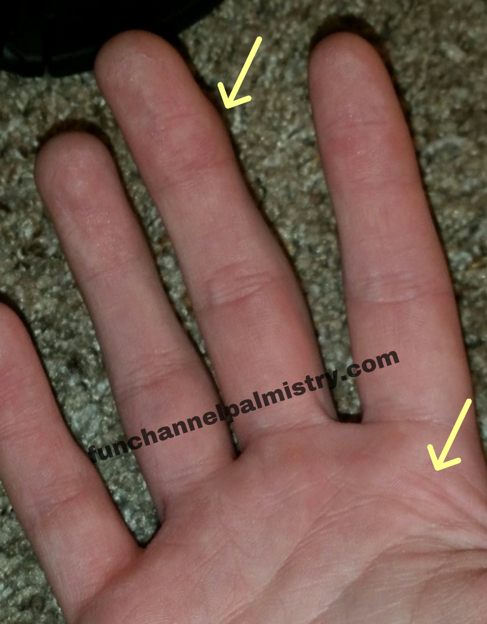 Palm Analysis Of A Stressed Person At A Young Age-Palmistry