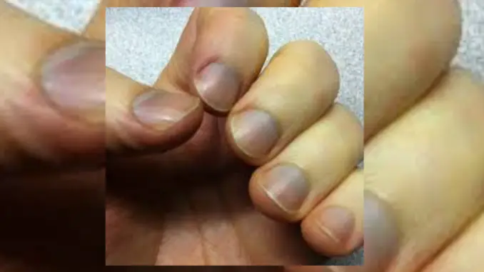 The Nails Tells A Lot About Your Health And Personality-Palmistry